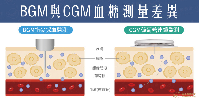 Cgm連續血糖監測 存奕美學診所